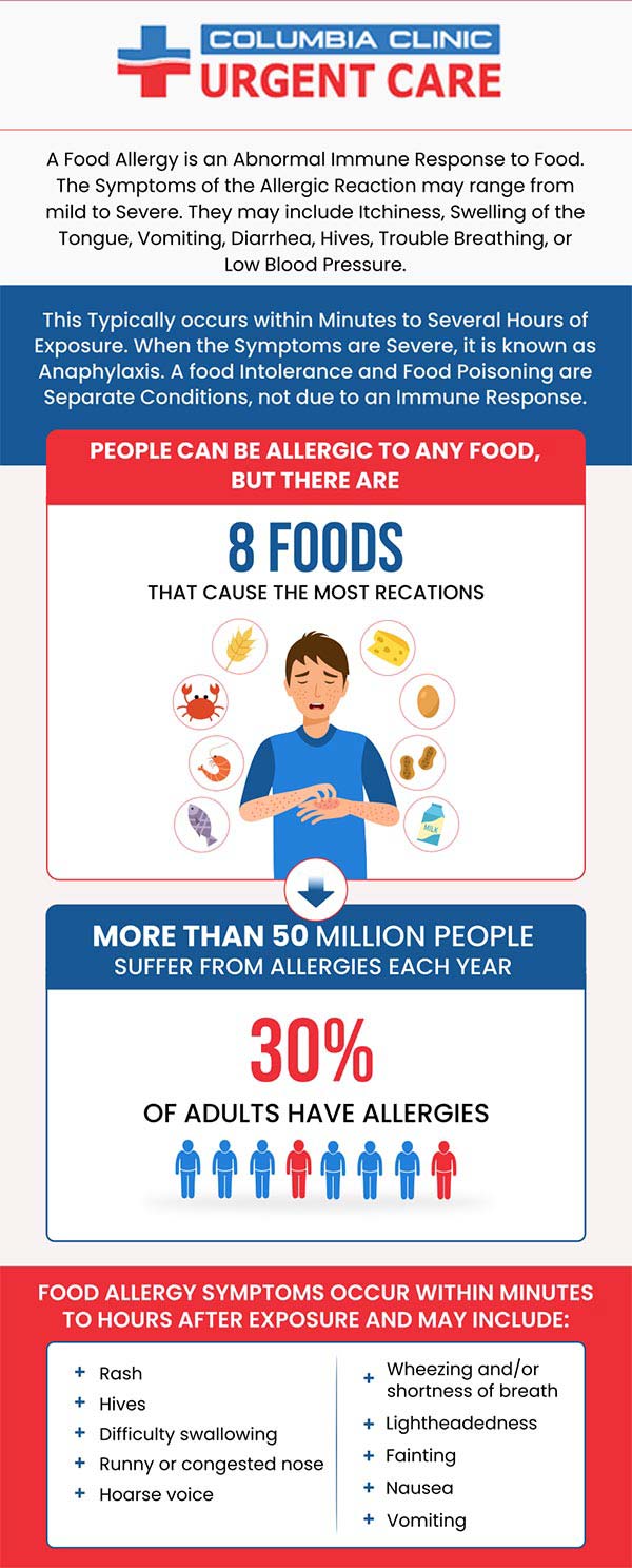 Food Allergies Treatment Clinic Near Me | Columbia Clinic Urgent Care