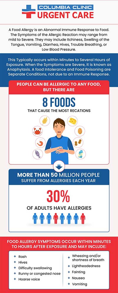 Food Allergies Treatment Clinic Near Me | Columbia Clinic Urgent Care