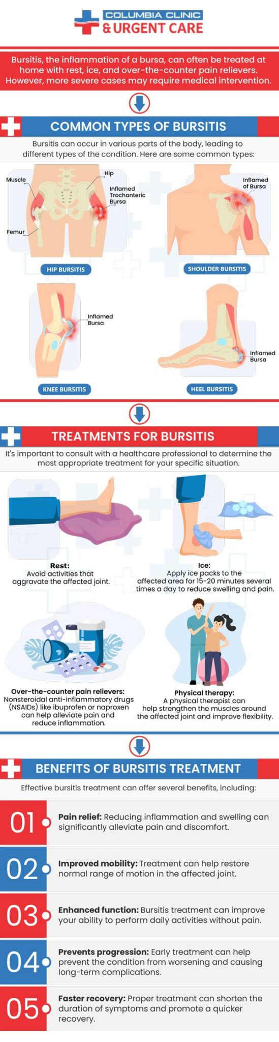 Bursitis Treatment Clinic Near Me | Columbia Clinic Urgent Care