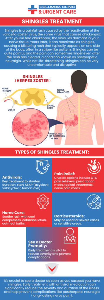 Shingles Treatment: What to Expect and How to Find Relief